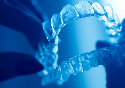 Ortho / Essix Retainers | Partridge Dental Lab